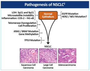 Clinician Toolkit – NSCLC